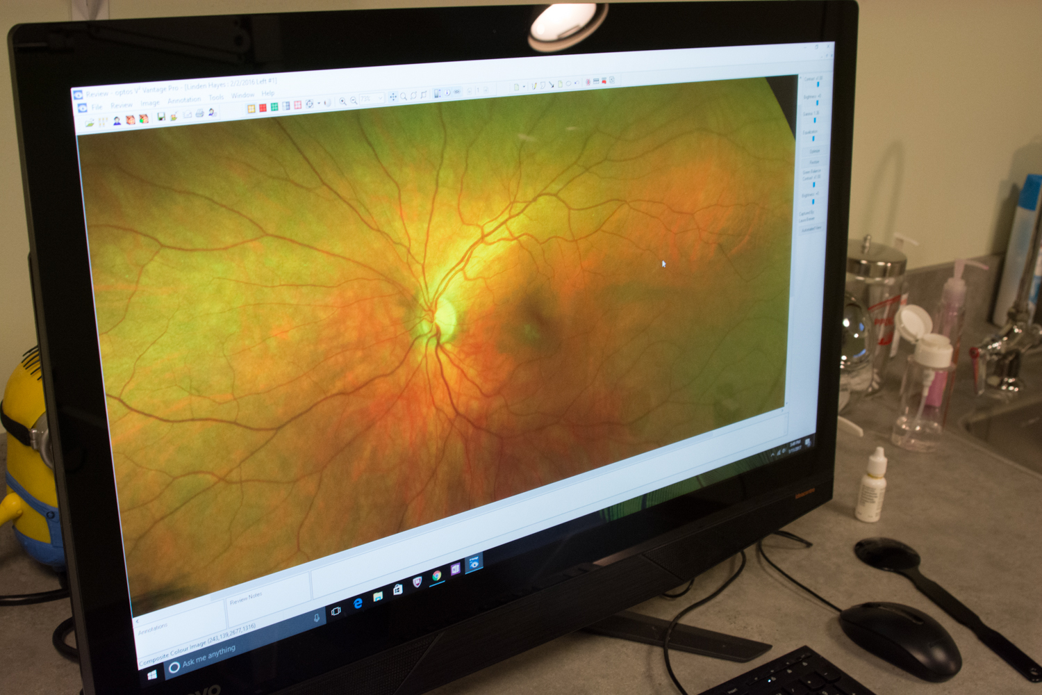 Adult Eyecare – Grace Vision Care